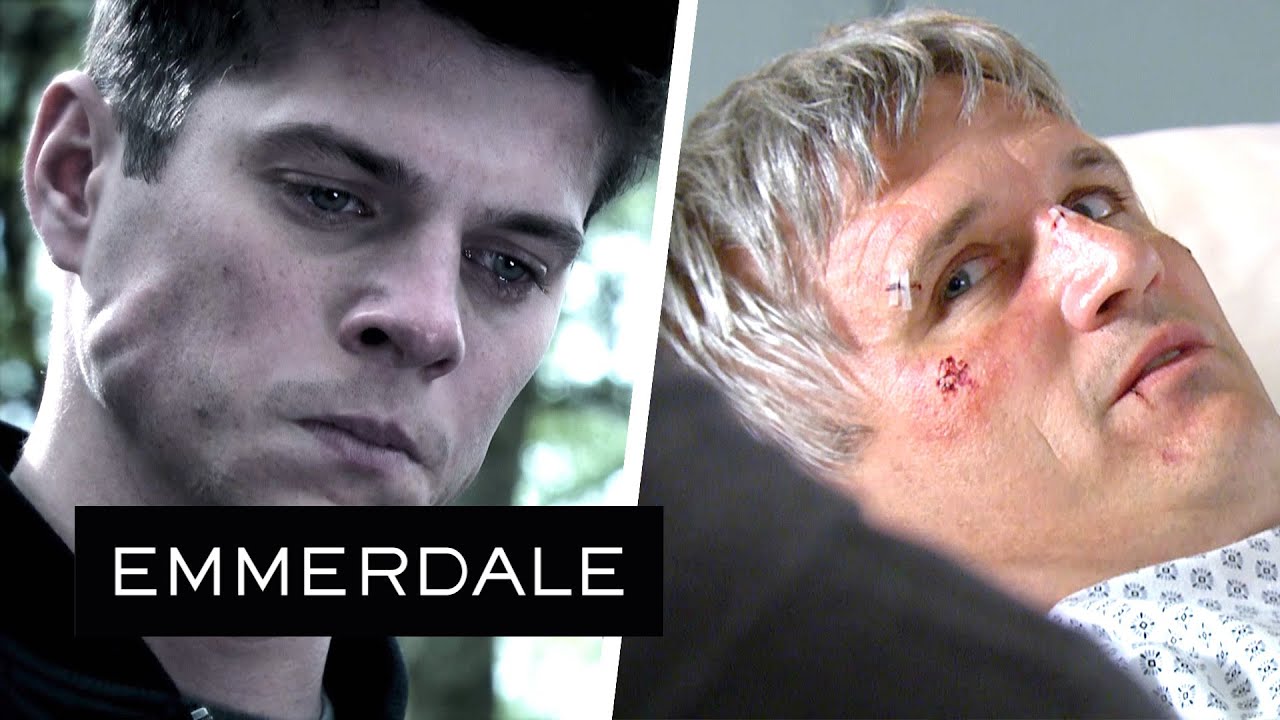 Apoilers: Emmerdale – Caleb Flatlines as Joe's Twisted Kidney Plan Unfolds